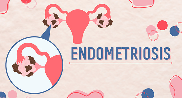 Endometriosis - Pathogenesis & Management | SAKSHAM LMIS - NIHFW